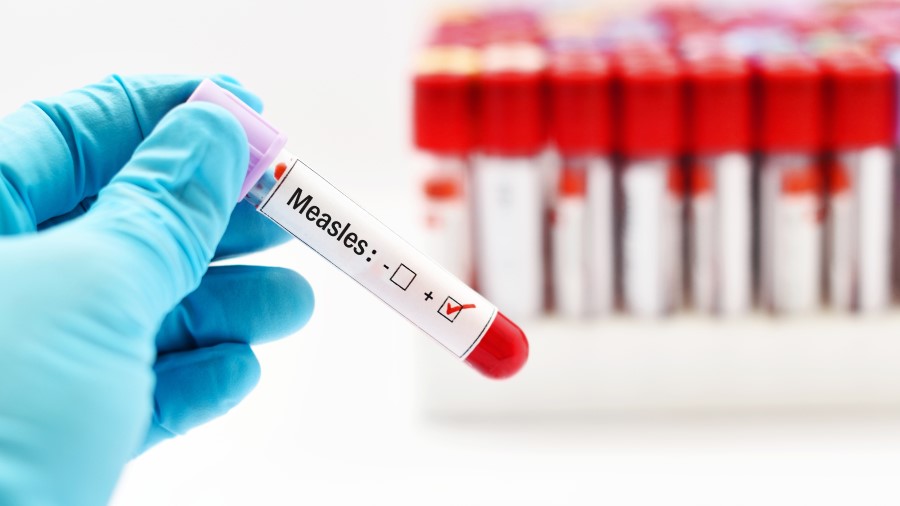 Vaccination Is Your Best Protection Against Measles