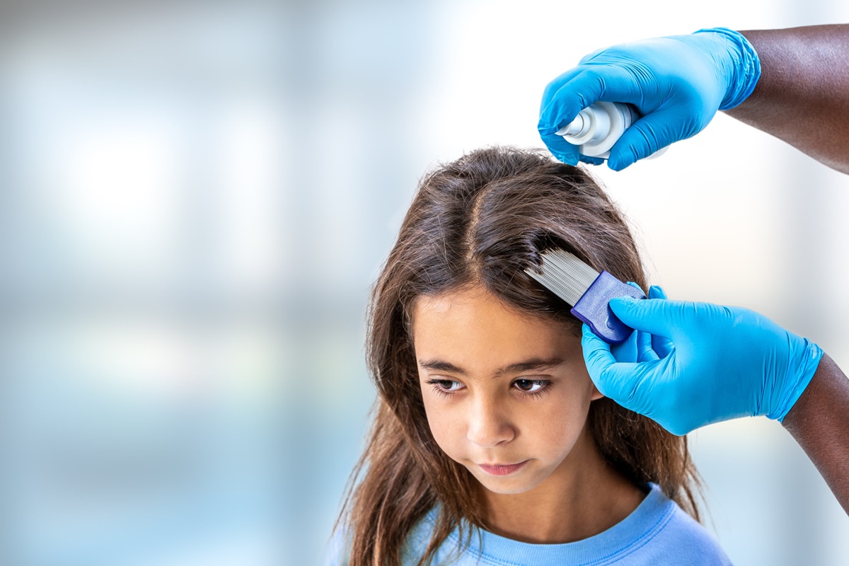 Head Lice: How to Identify, Treat, and Prevent Further Spread